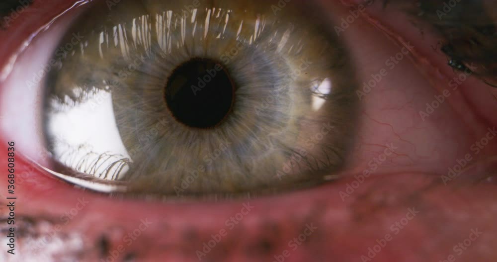 Pupil of gray eye contracts Stock Video | Adobe Stock