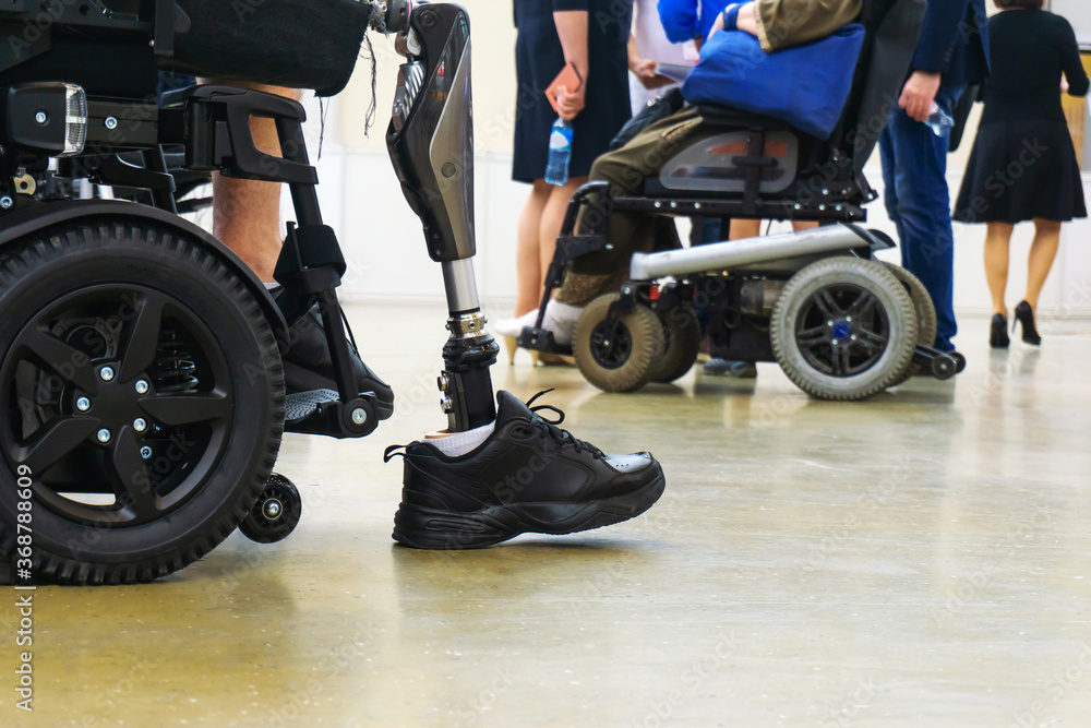 The disabled person received a new bionic prosthesis and is trying to ...