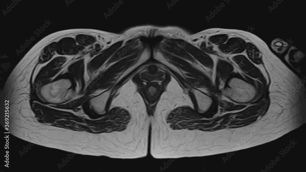 MRI of the female pelvic organs, abdominal cavity, gastrointestinal ...