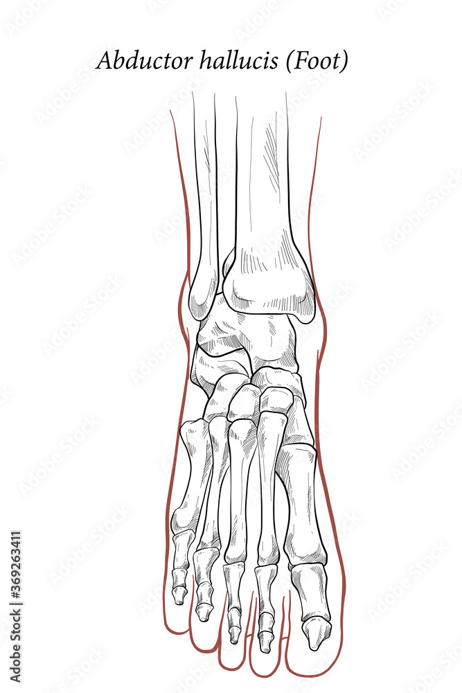 Medical illustration of Abductor hallucis muscle foot. Stock Vector ...