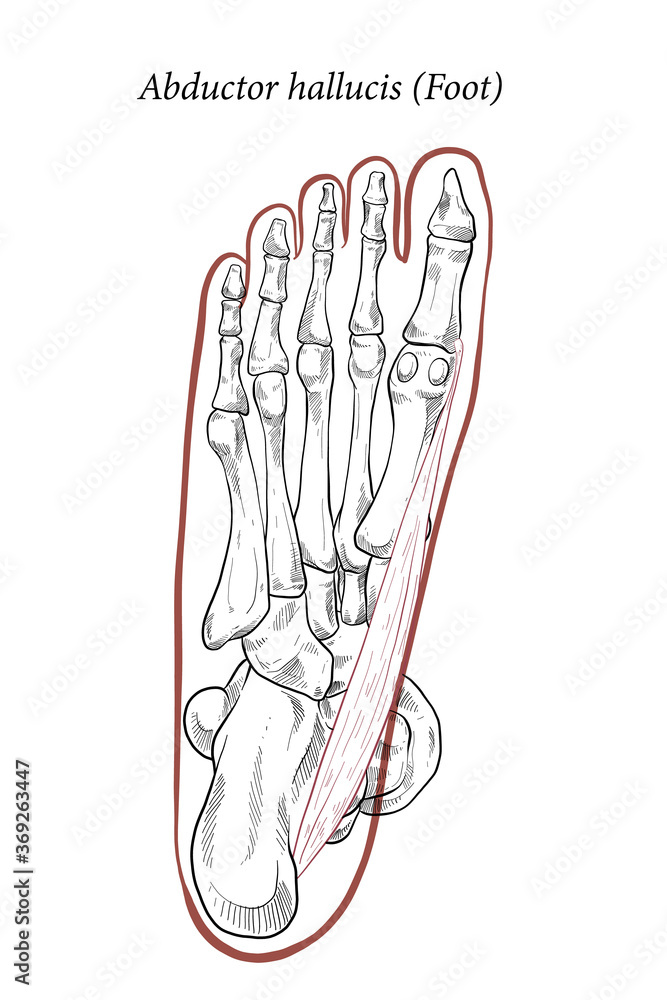 Medical illustration of Abductor hallucis muscle foot. Stock Vector ...