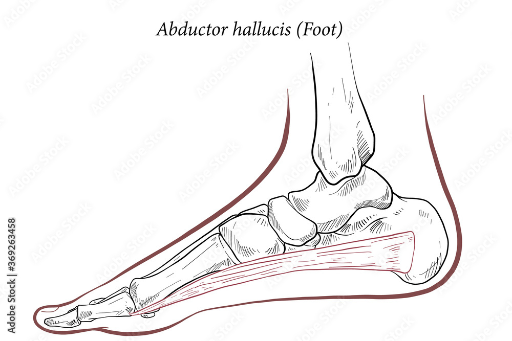 Medical illustration of Abductor hallucis muscle foot. Stock Vector ...