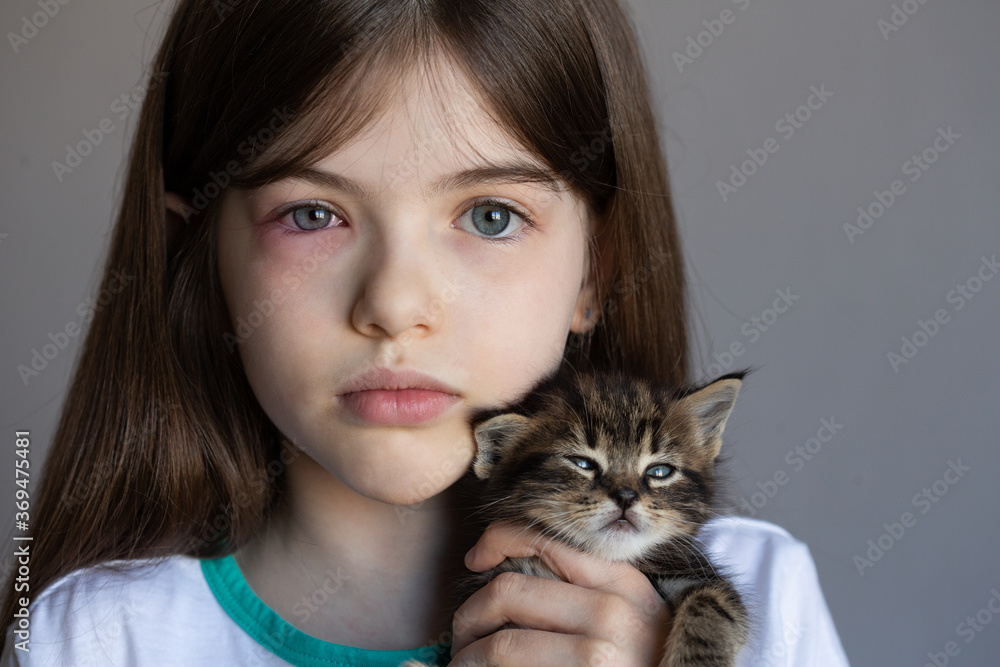 Little girl holding a kitten. Allergy to cat hair, red eye, lacrimation ...