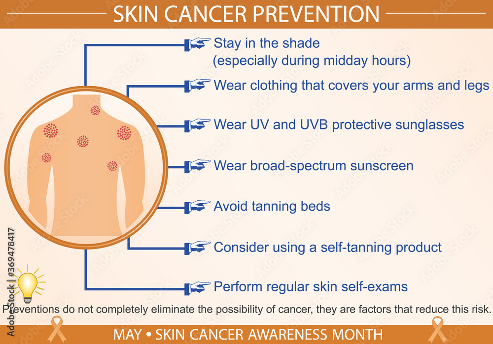 Skin Cancer Prevention Poster