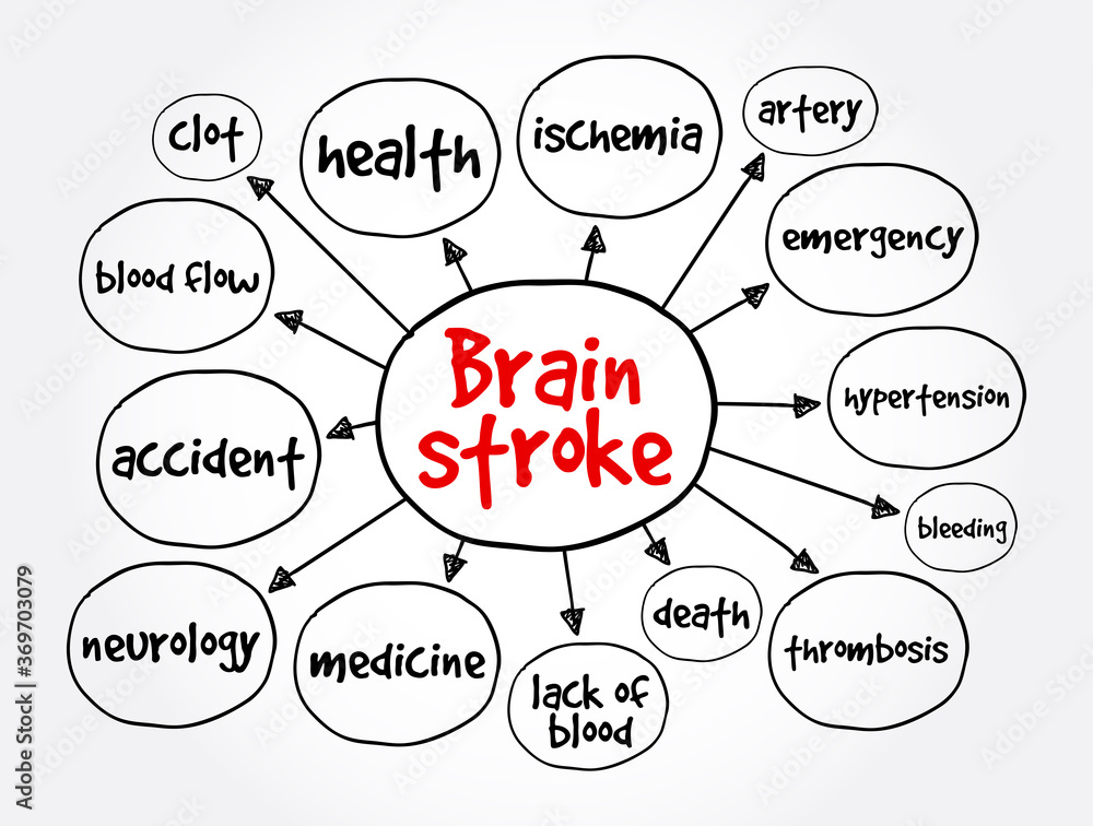 Brain stroke mind map, medical concept for presentations and reports ...