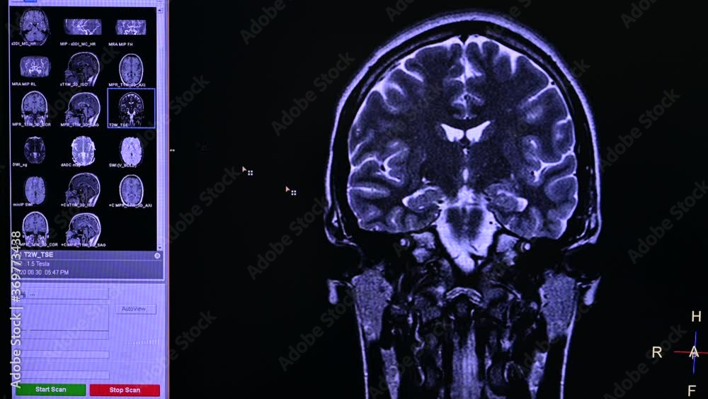 Vidéo Stock Close up video of a MRI (Magnetic Resonance Imaging) or CAT ...