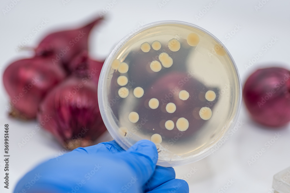 Bacterial culture plate shoiwng E. coli / salmonella colony isolated ...
