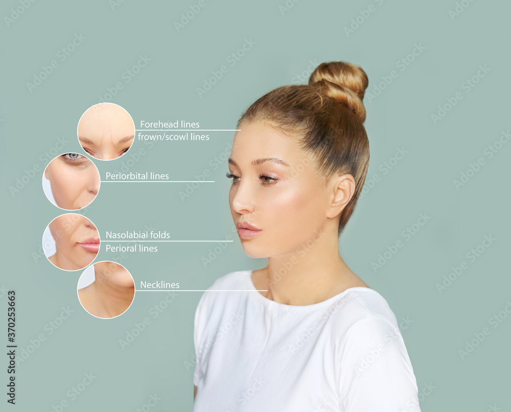 Effects of ageing,Frown/scowl lines ,Nasolabial folds,Neck ,Under eye ...
