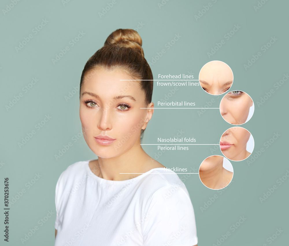 Effects of ageing,Frown/scowl lines ,Nasolabial folds,Neck ,Under eye ...