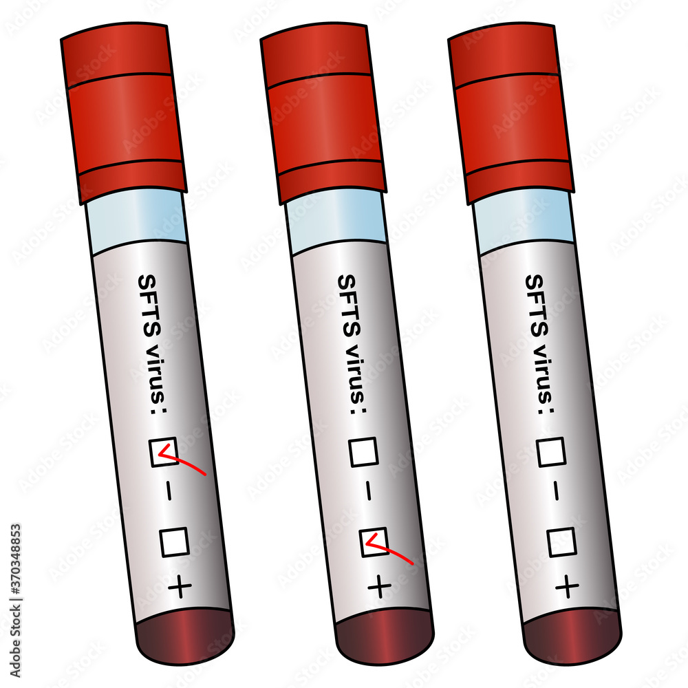 SFTS virus and test tubes with patient analyzes. Vector set of ...
