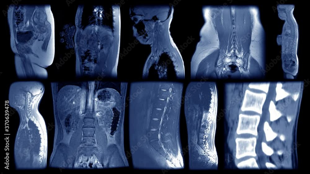 MRI scans set multi screen, human brain, head, body, bones, spine and ...