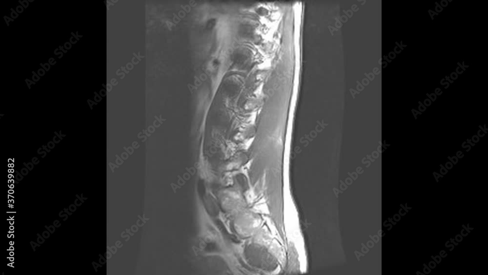 MRI scan timelapse of various sides human body, spine, bones organs ...