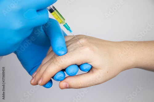 An orthopedic surgeon gives an injection in the wrist. Treatment of ...