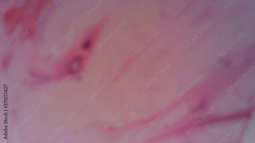 Microscope Human Skin Sweat Gland 1200x Slides Moving vídeo do Stock ...