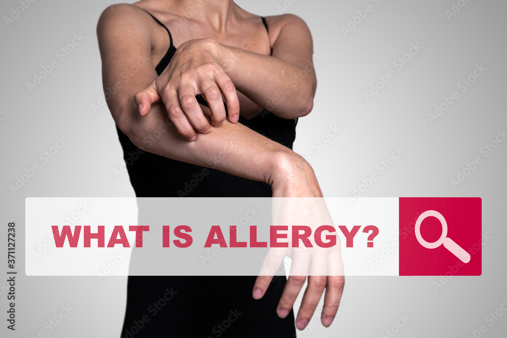 WHAT IS ALLERGY. Skin health, symptoms, stress and treatment concept ...