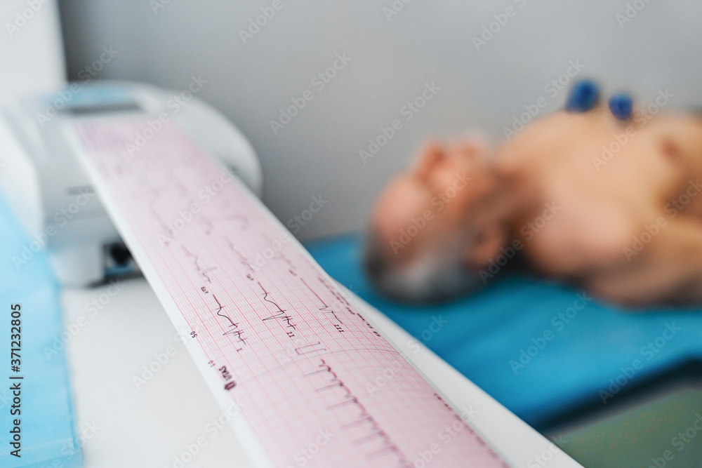 ECG. Cardiogram printout on male patient background Stock Photo | Adobe ...