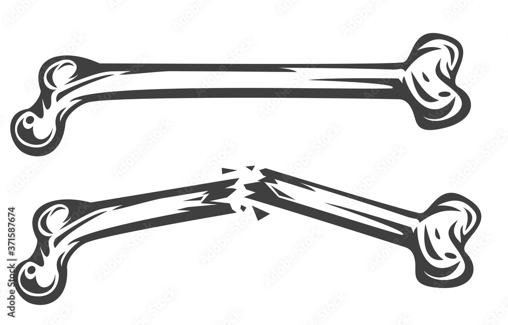 Vintage monochrome whole and broken bone isolated on white background ...