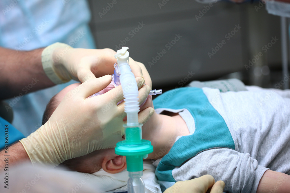 Introduction of the child into General anesthesia before surgery. The ...