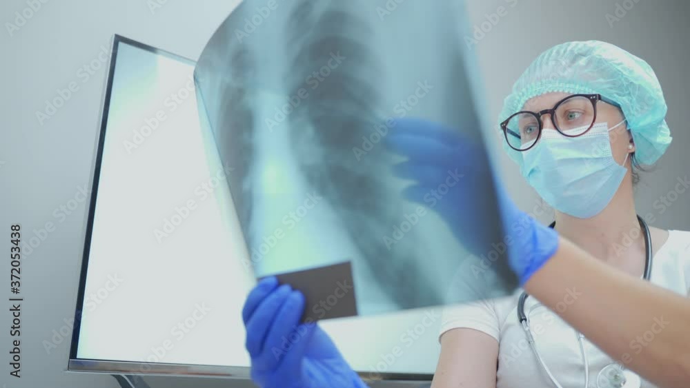 female doctor therapist examines the fluorography. woman pulmonologist ...