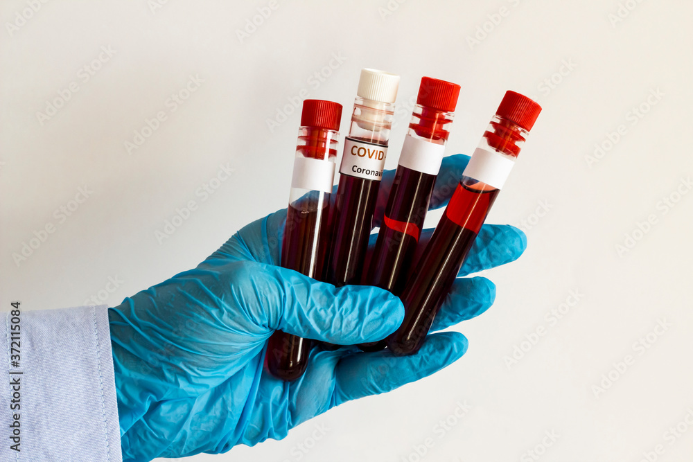 Laboratory worker in blue gloved is holding four blood tubes, one of ...