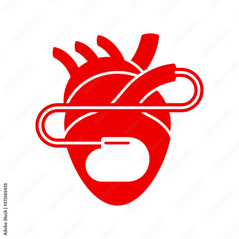 Pacemaker illustration - human heart and cardio implant - vector ...