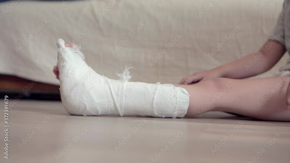 broken leg. Close-up of the cast on the feet. exercises to repair and ...