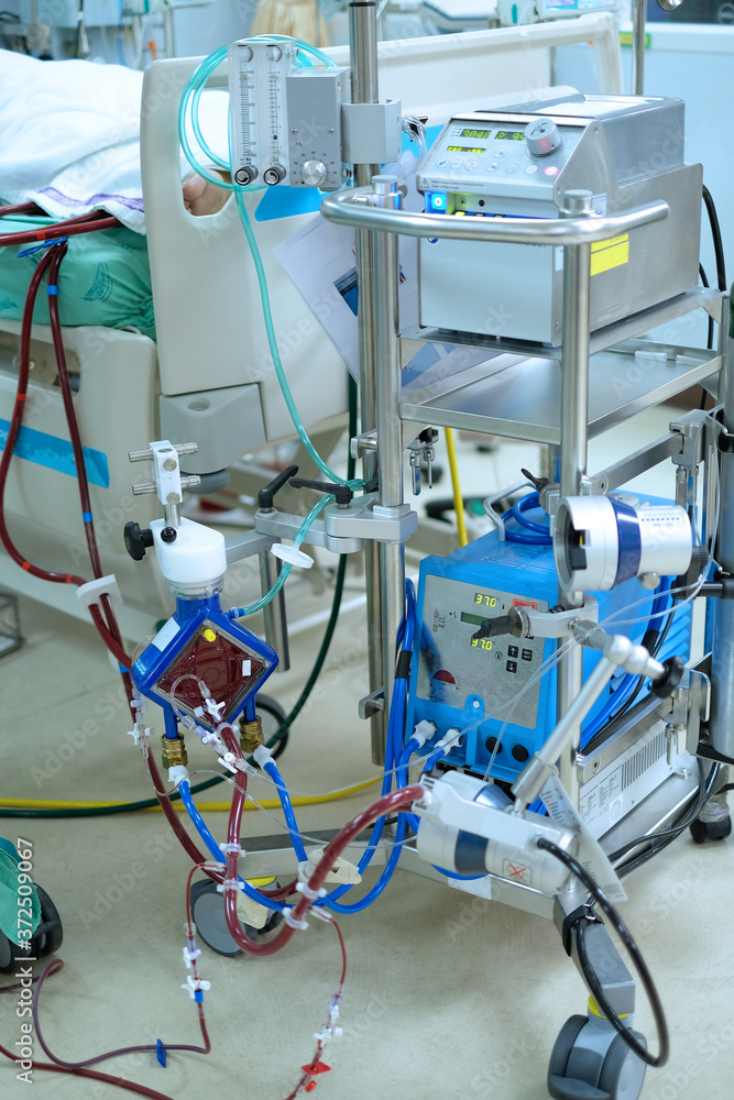 Extracorporeal Membrane Oxygenation