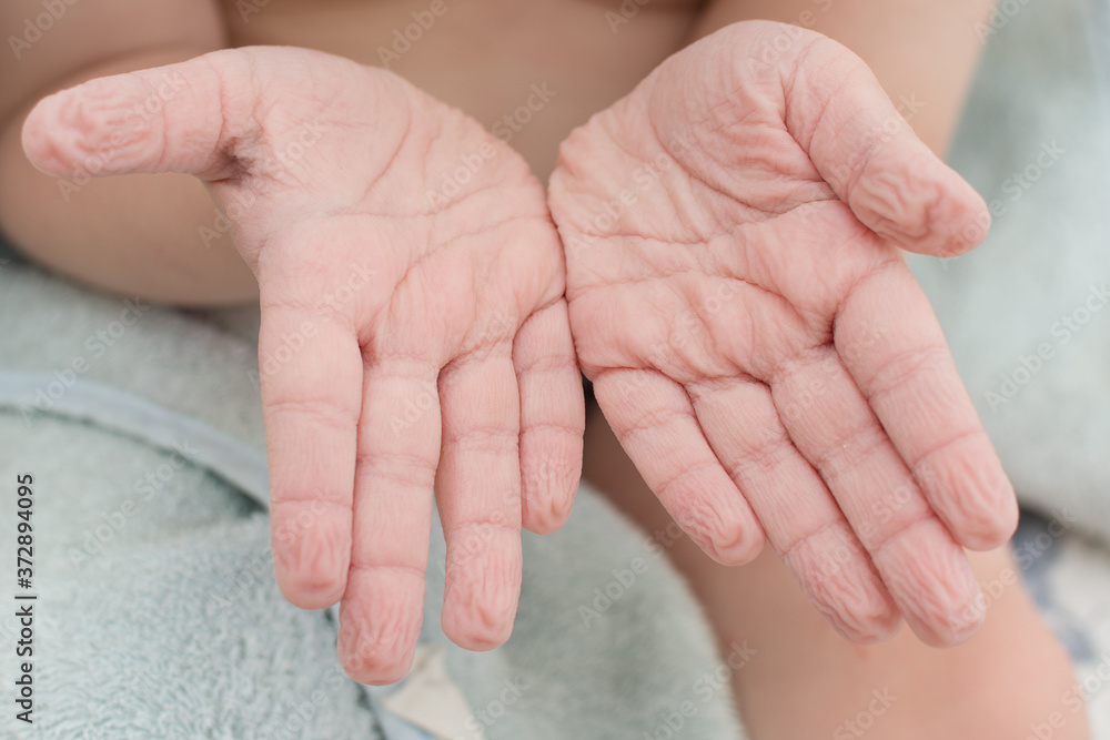 baby hands wrinkled from the water close-up. Clean skin washed after ...