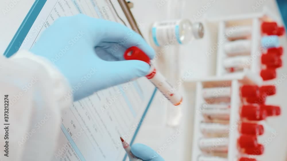 Vertical footage laboratory technician holds in one hand laboratory ...