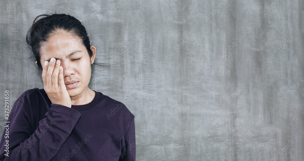 Asian woman has eye pain on concrete wall for texture background with ...