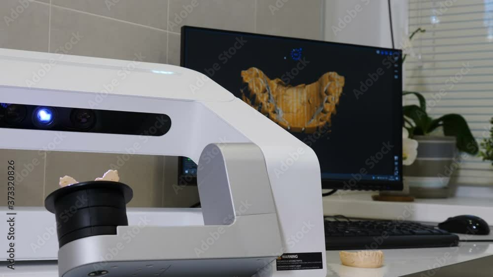 3d tooth scanning in modern dentistry. Dental prosthetic restoration ...