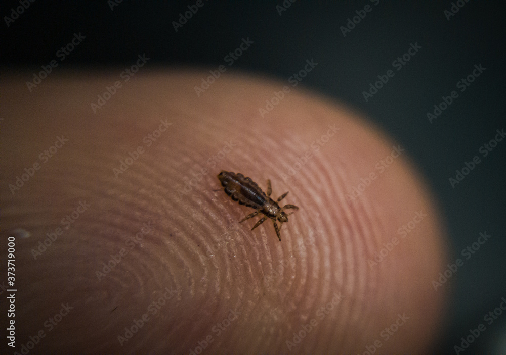 A Head Louse! Adult lice are small flattened & entirely wingless ...