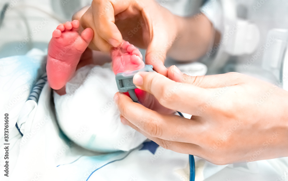 Nurse is putting on the foot of neonatal premature infant pulse ...