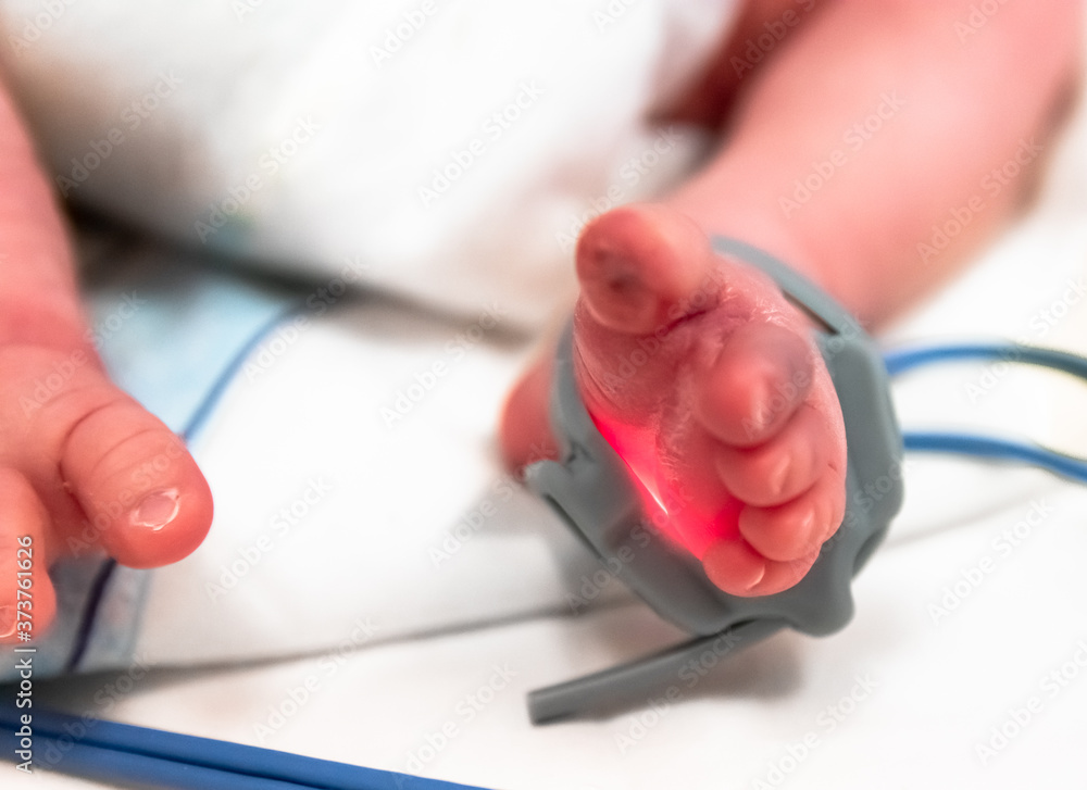 Premature baby feet with a neonatal pulse oximetry monitor, selective ...