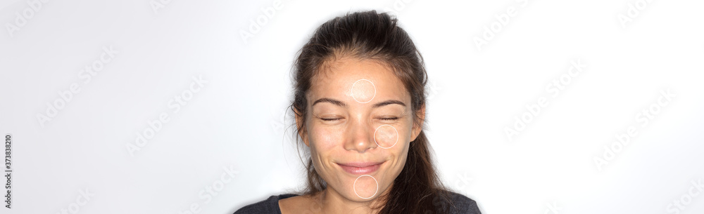 Portrait of Asian woman with different skin care problems on face ...