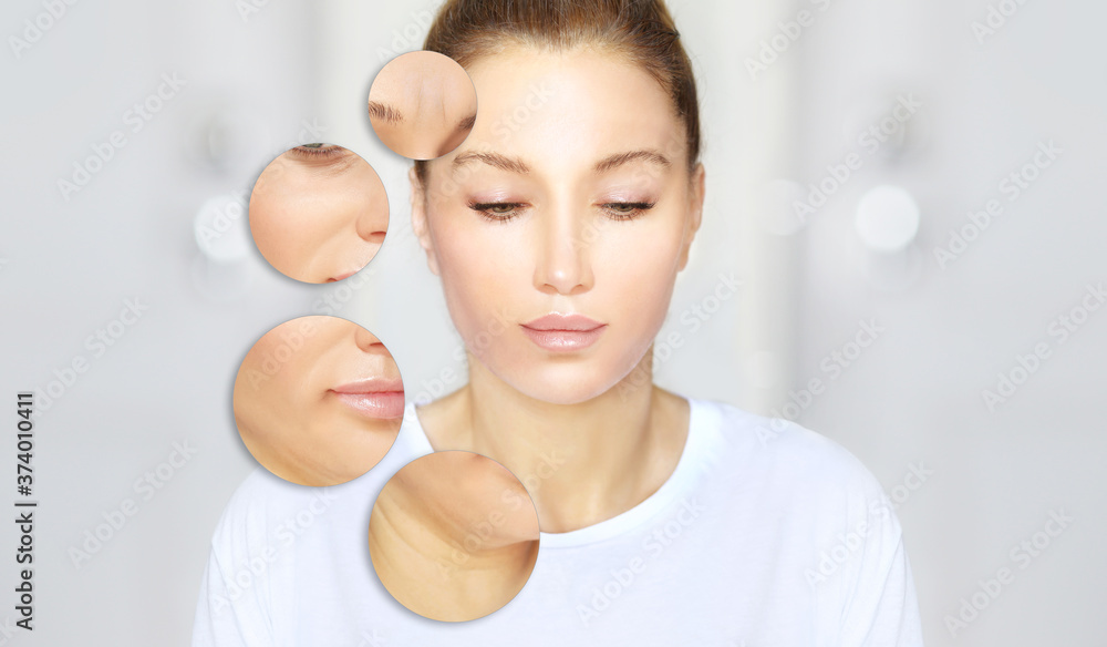 Effects of ageing,Frown/scowl lines ,Nasolabial folds,Neck ,Under eye ...