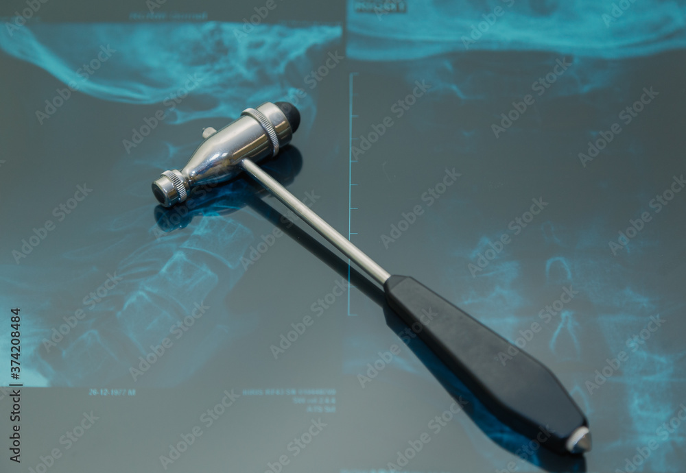 Neurologist's iron hammer on x-ray at the clinic. Stock Photo | Adobe Stock