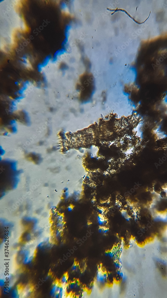 Mycetozoa slime mold and Purple sulfur bacteria PSB in dead shell of ...