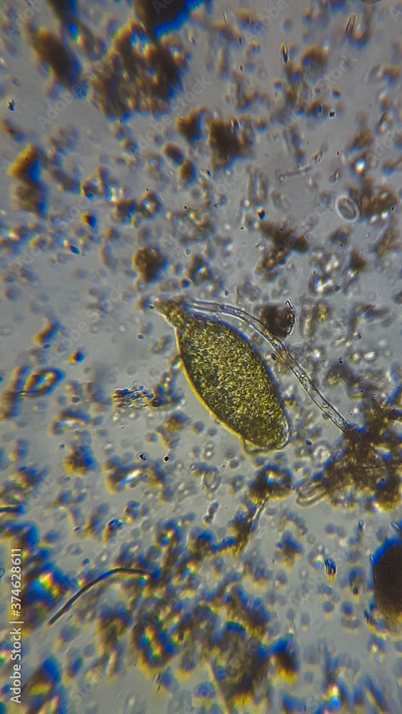 Mycetozoa slime mold and Purple sulfur bacteria PSB in dead shell of ...