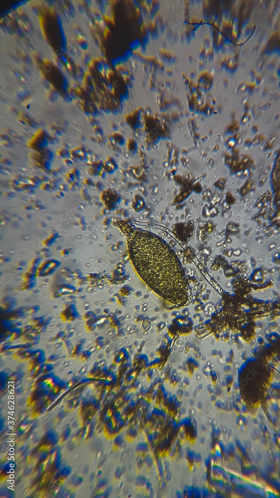 Fotografia do Stock: Mycetozoa slime mold and Purple sulfur bacteria ...