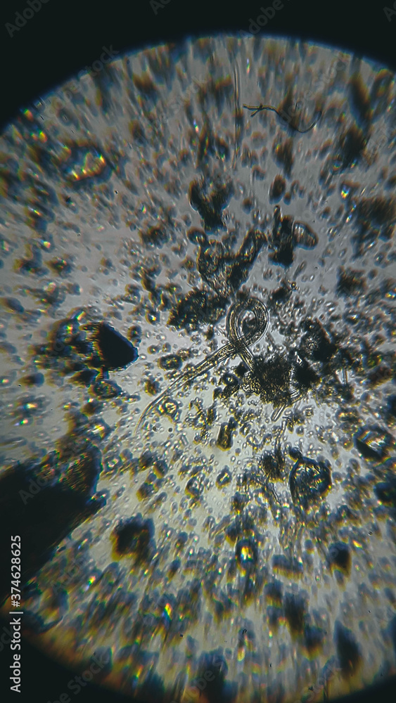 Foto de Mycetozoa slime mold and Purple sulfur bacteria PSB in dead ...