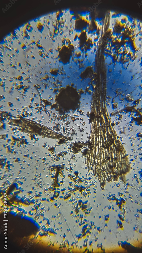 Foto de Mycetozoa slime mold and Purple sulfur bacteria PSB in dead ...