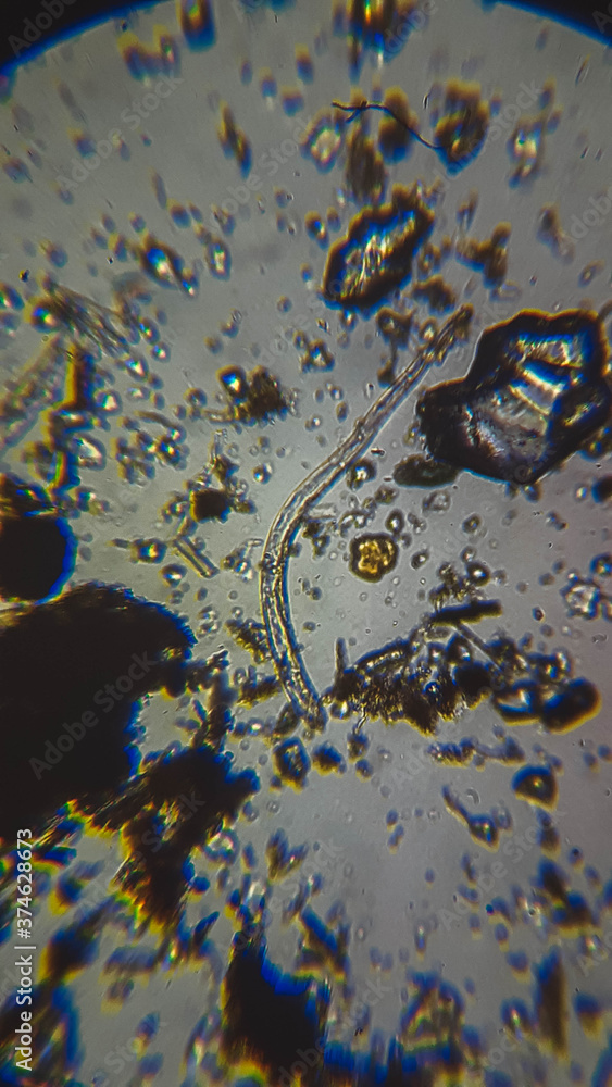 Bacteria Under Compound Microscope