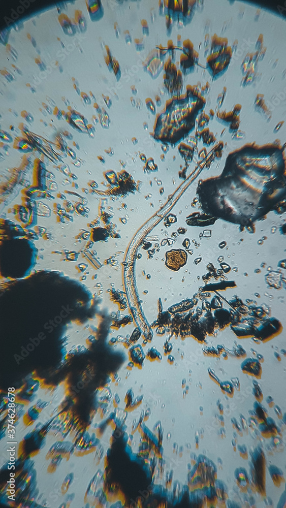 Foto de Mycetozoa slime mold and Purple sulfur bacteria PSB in dead ...