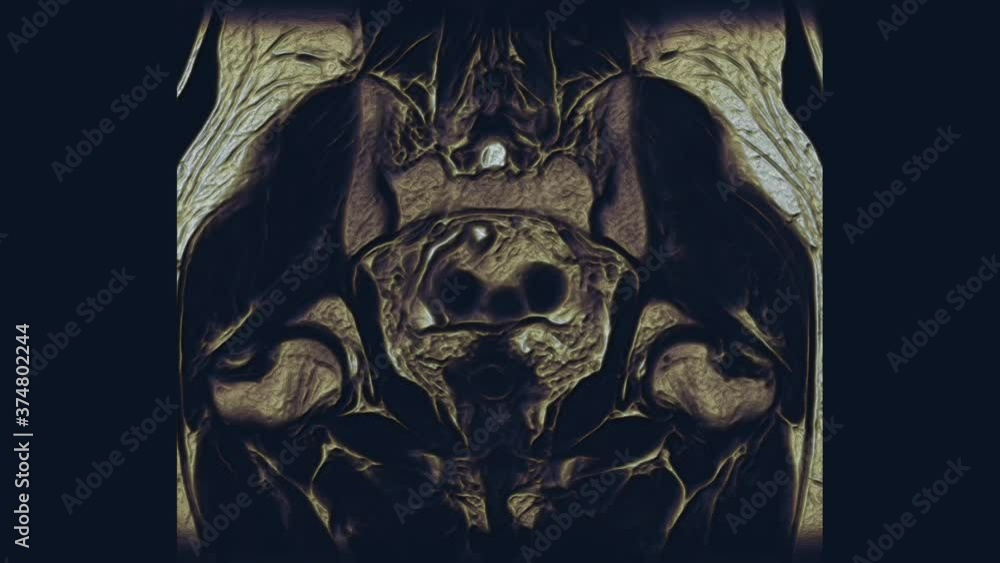 Voluminous color MRI of the female pelvic organs, abdominal cavity ...