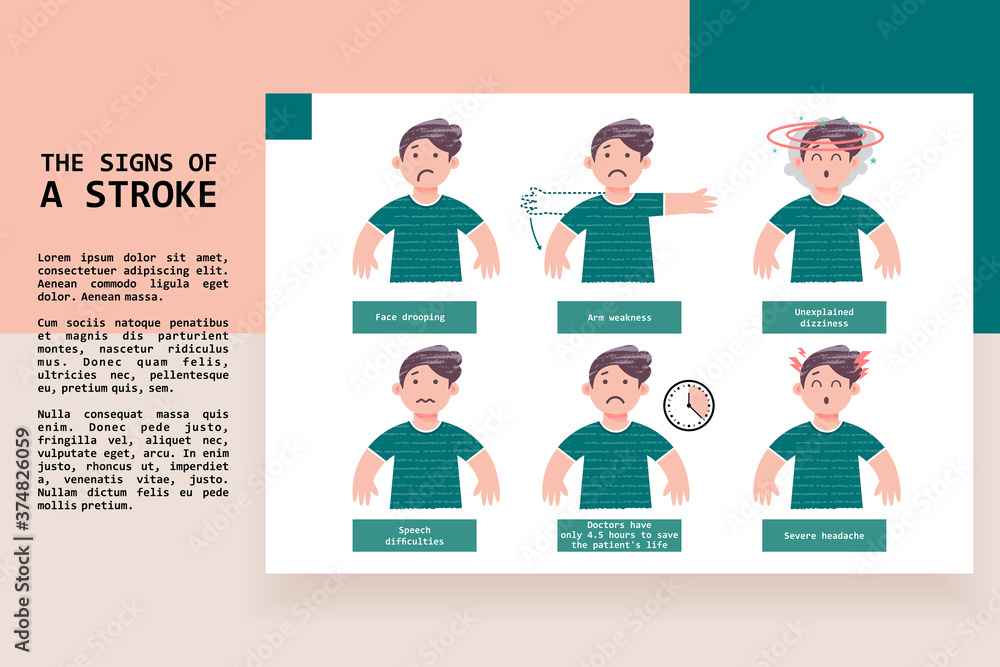 The signs of a stroke. Vector illustration, infographics. Stock Vector ...