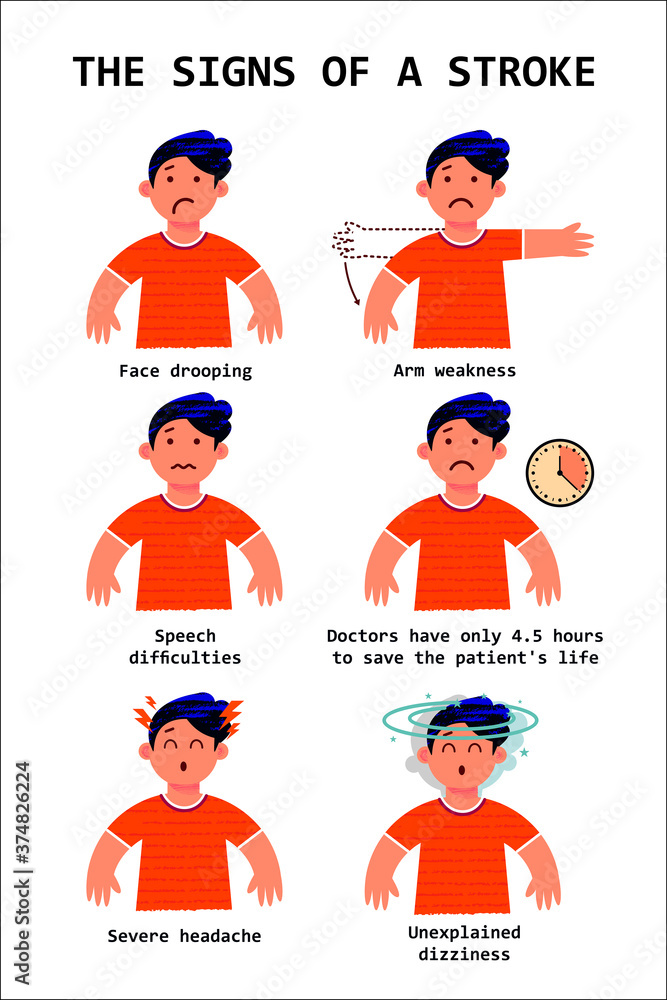 The signs of a stroke. Vector illustration, infographics. Stock Vector ...