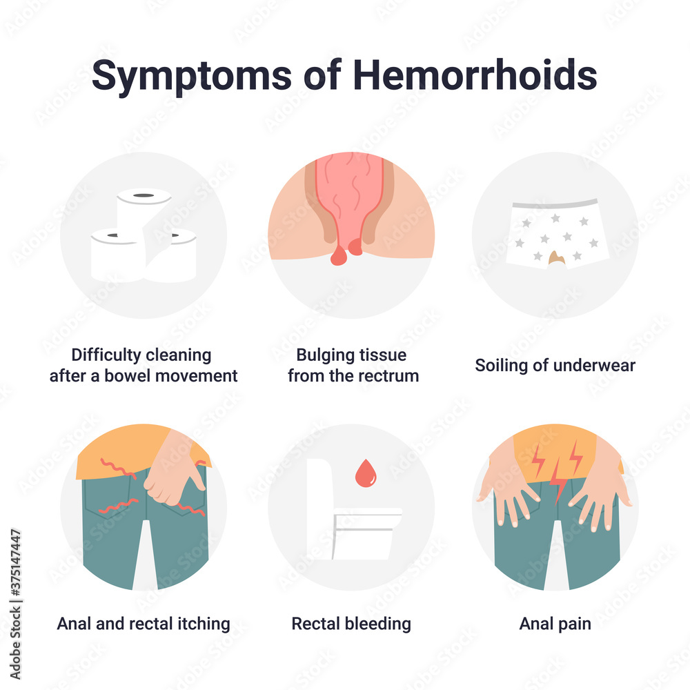 Set Infographic Medical Icons Symptoms Of Hemorrhoids Flat Vector Illustration Stock Vector