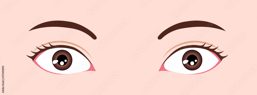 Eye shapes ( eyeball size and position ) vector illustration Stock ...
