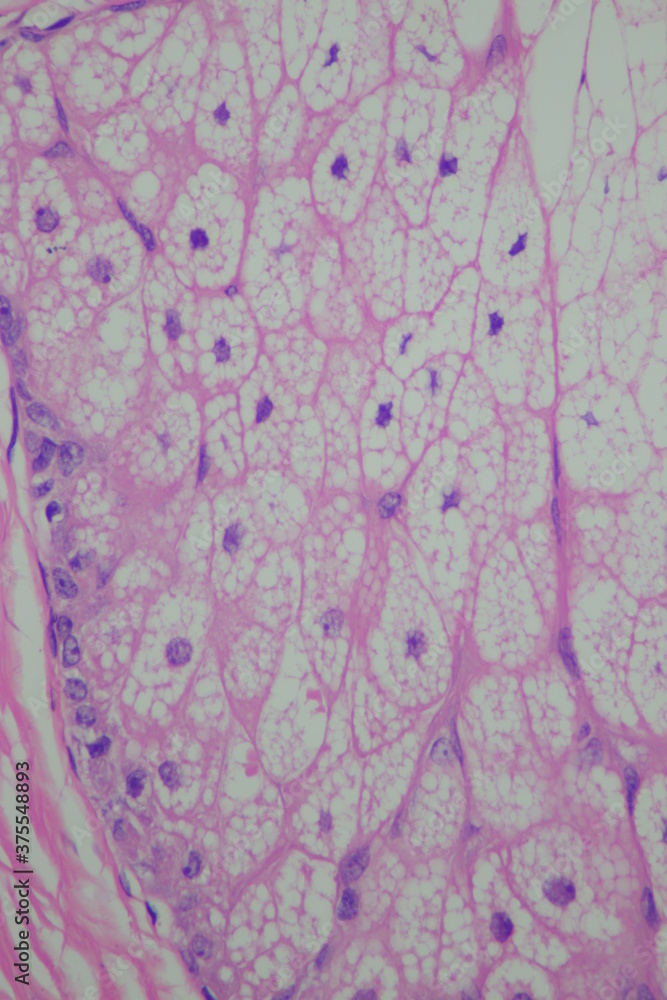 Normal sebaceous gland showing normal sebocytes with vacuolated ...